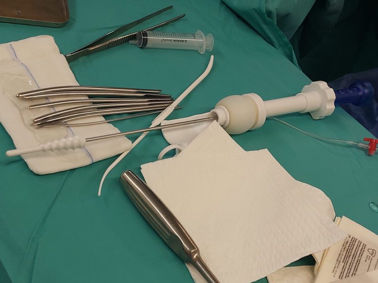 ¿Que es histerectomia total? Te explicamos los diferentes tipos de ...