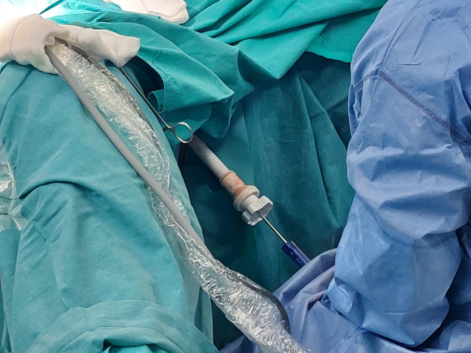 ¿Que es histerectomia total? Te explicamos los diferentes tipos de ...