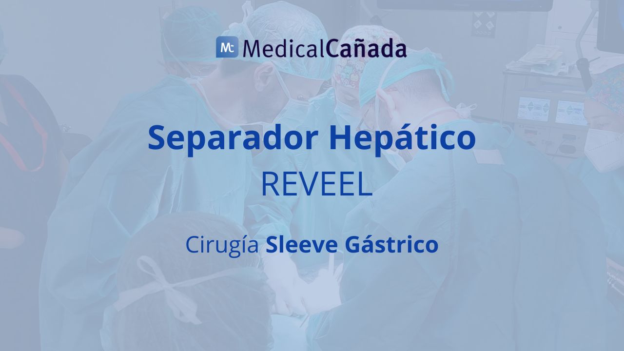 Separador Hepatico Laparoscopico REVEEL: el retractor de tejidos y ...